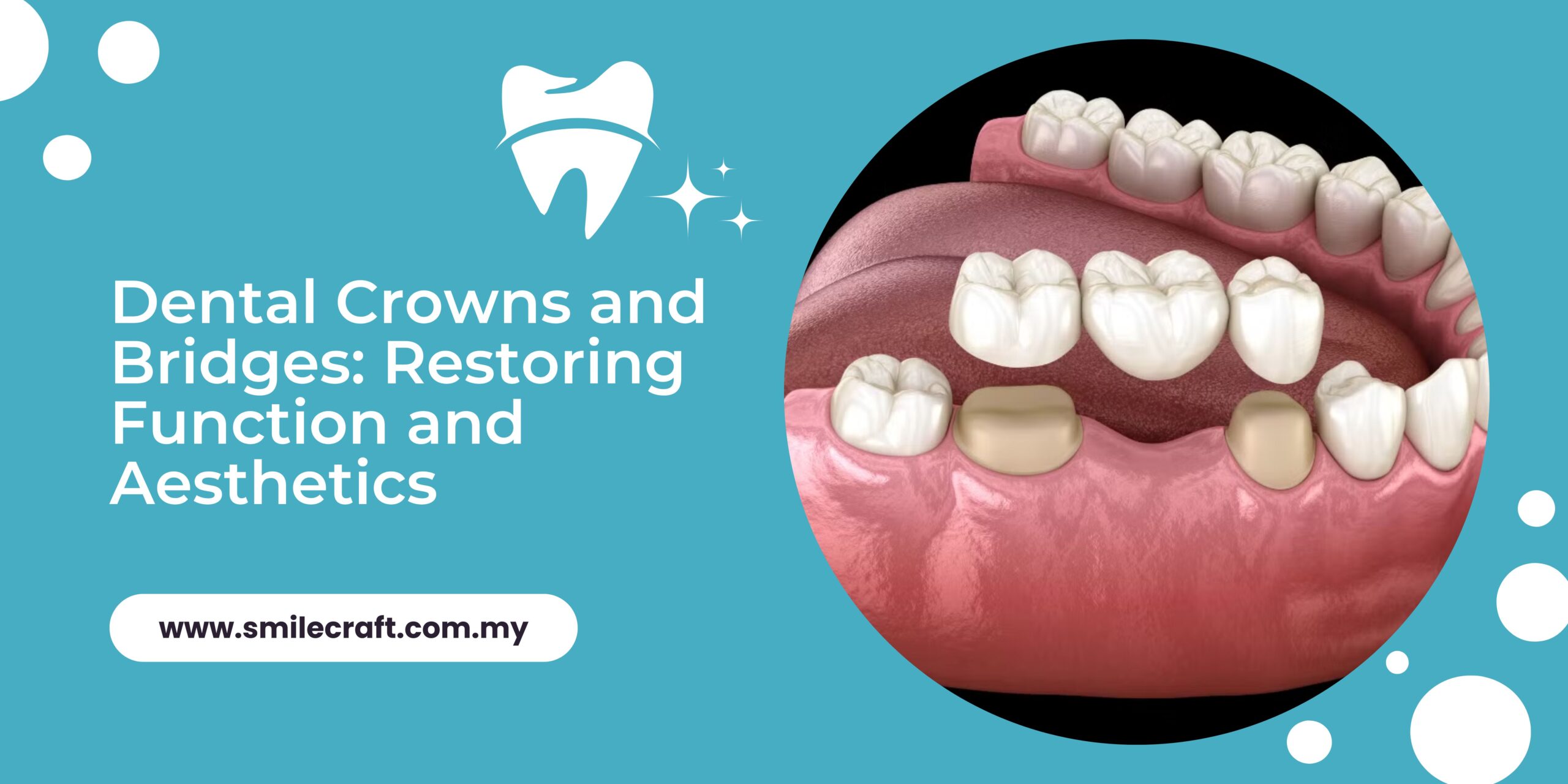 Dental Crowns and Bridges: Restoring Function and Aesthetics